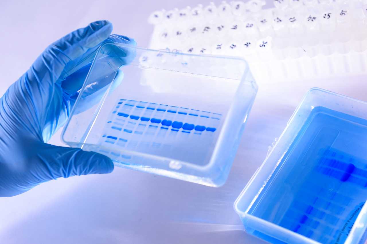 Farmaco salvavita introvabile: requisito per emergenza coronavirus Farmaco salvavita introvabile: requisito per emergenza coronavirus